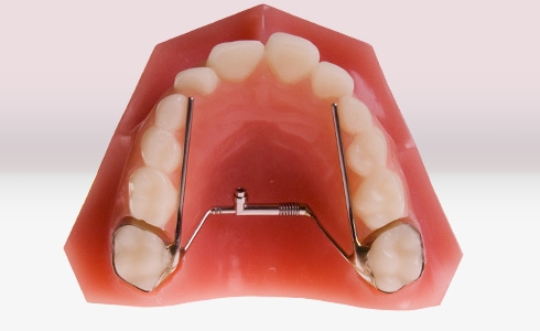 Braces - BracesAmerica